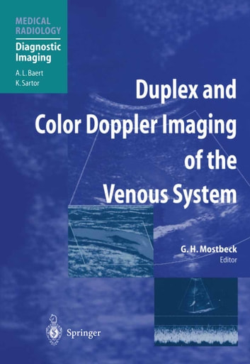 Buy Duplex and Color Doppler Imaging of the Venous System online