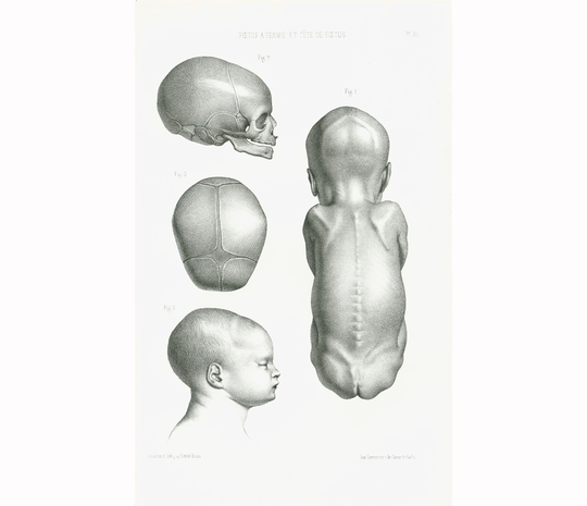 Buy 1865 Human Fetus, Antique Obstetrics Print, Anatomy Embryology ...