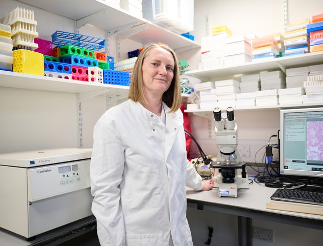Our research | Ovarian Cancer Action